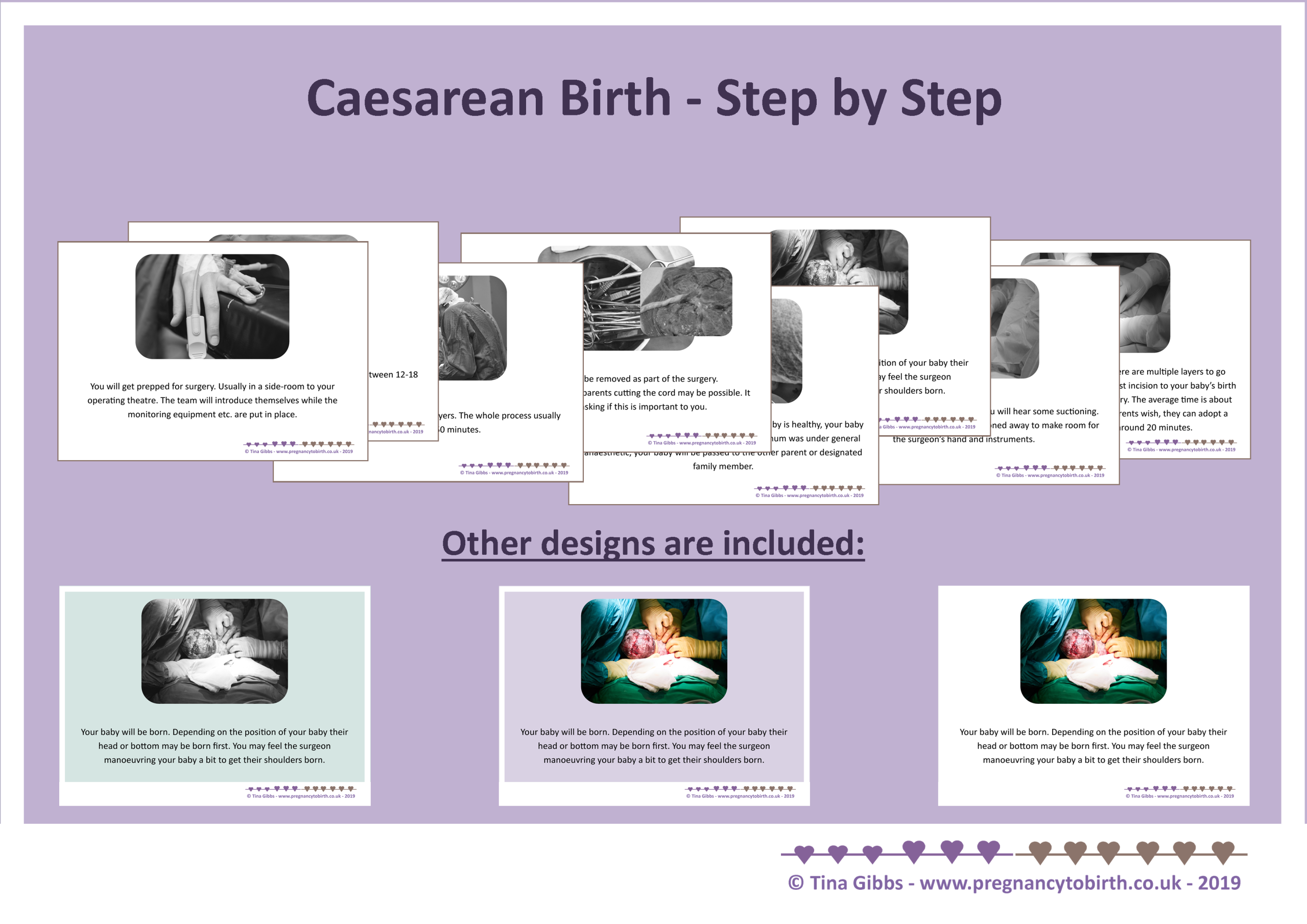 Caesarean Birth Step-by-Step - perinatal education - Tina Gibbs