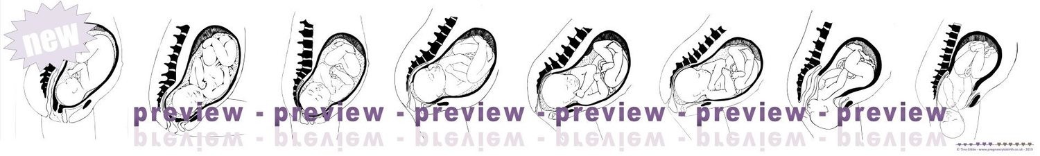 Singleton Birth Process Banner - Tina Gibbs childbirth education