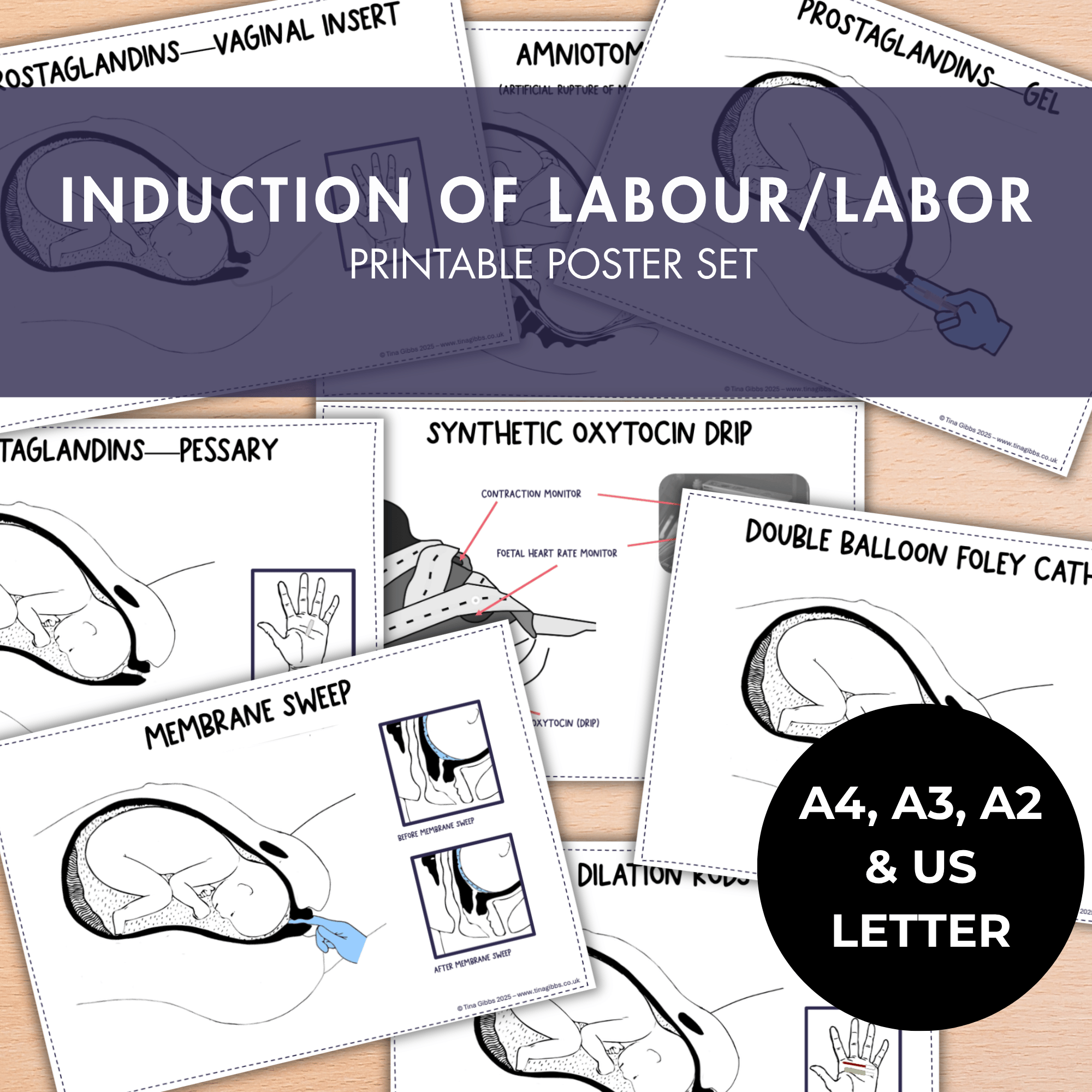 Induction of labour posters (pdf) + editable PowerPoint & Google Slides ...