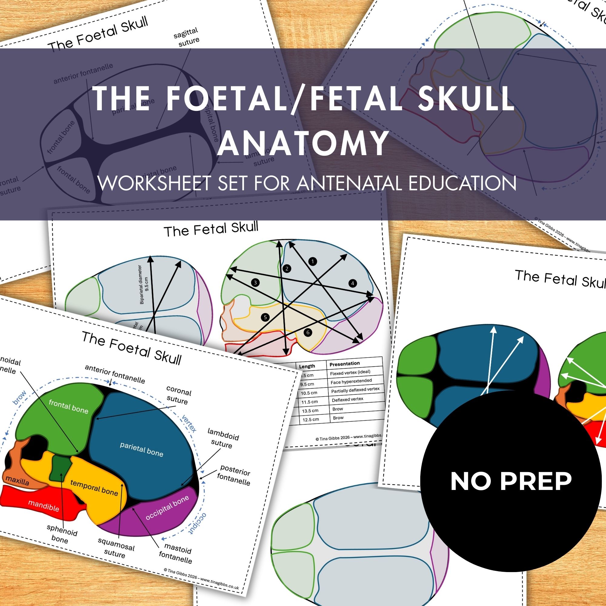Foetal Skull Anatomy Worksheets (pdf)